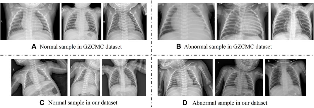 Frontiers | Accurate and intelligent diagnosis of pediatric pneumonia ...