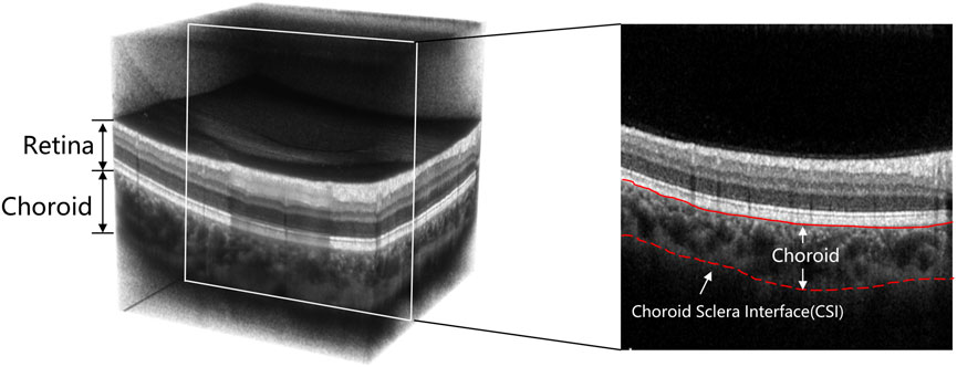 Frontiers | Choroidal layer segmentation in OCT images by a boundary ...