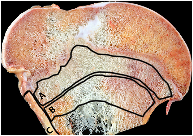 Frontiers | Bone quality changes as measured by Raman and FTIR ...