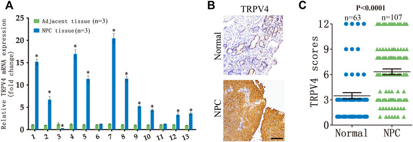 Frontiers | Transient receptor potential vanilloid type 4 (TRPV4 ...