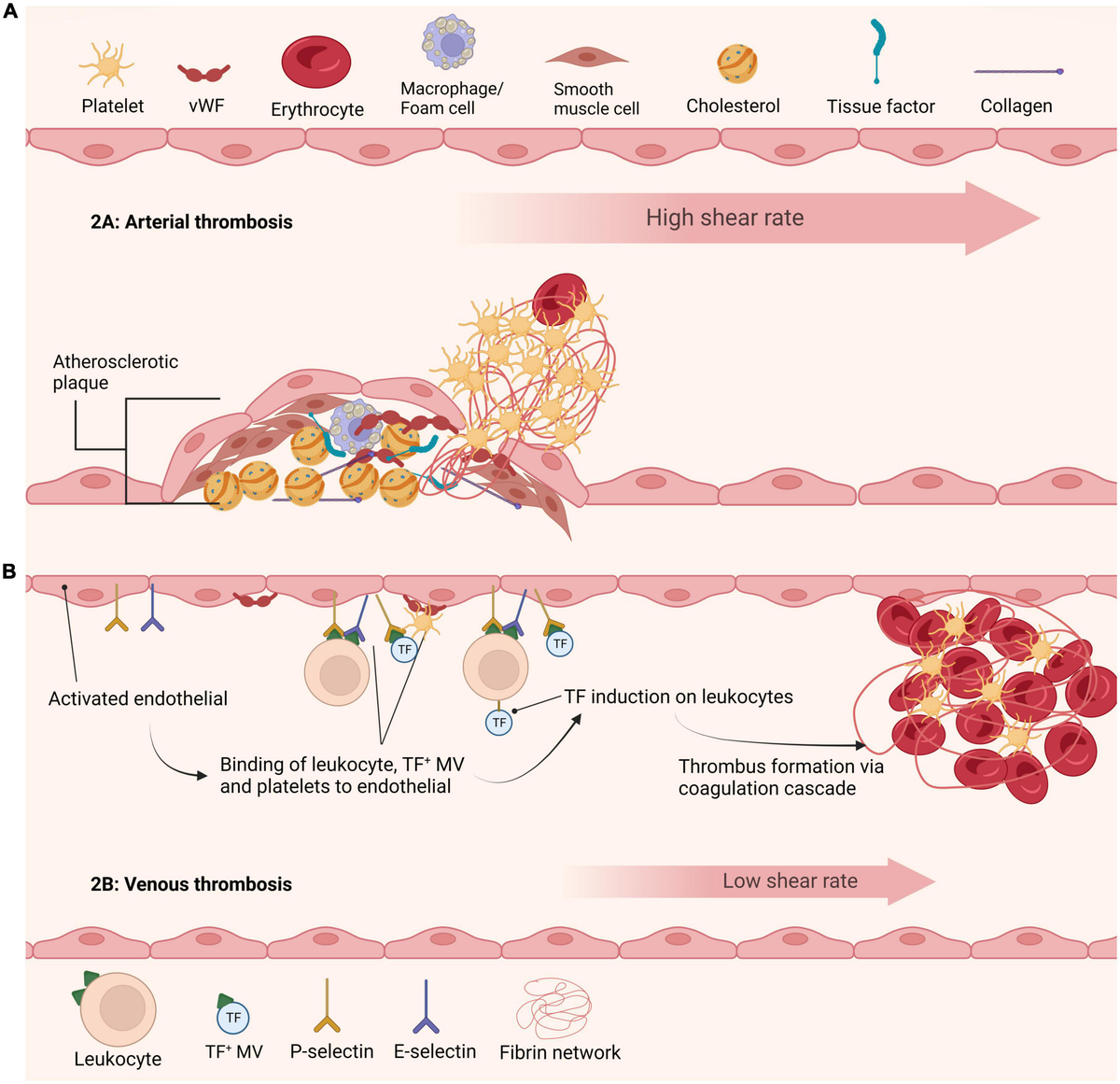 Frontiers | Location, location, location: Fibrin, cells, and fibrinolytic factors in thrombi