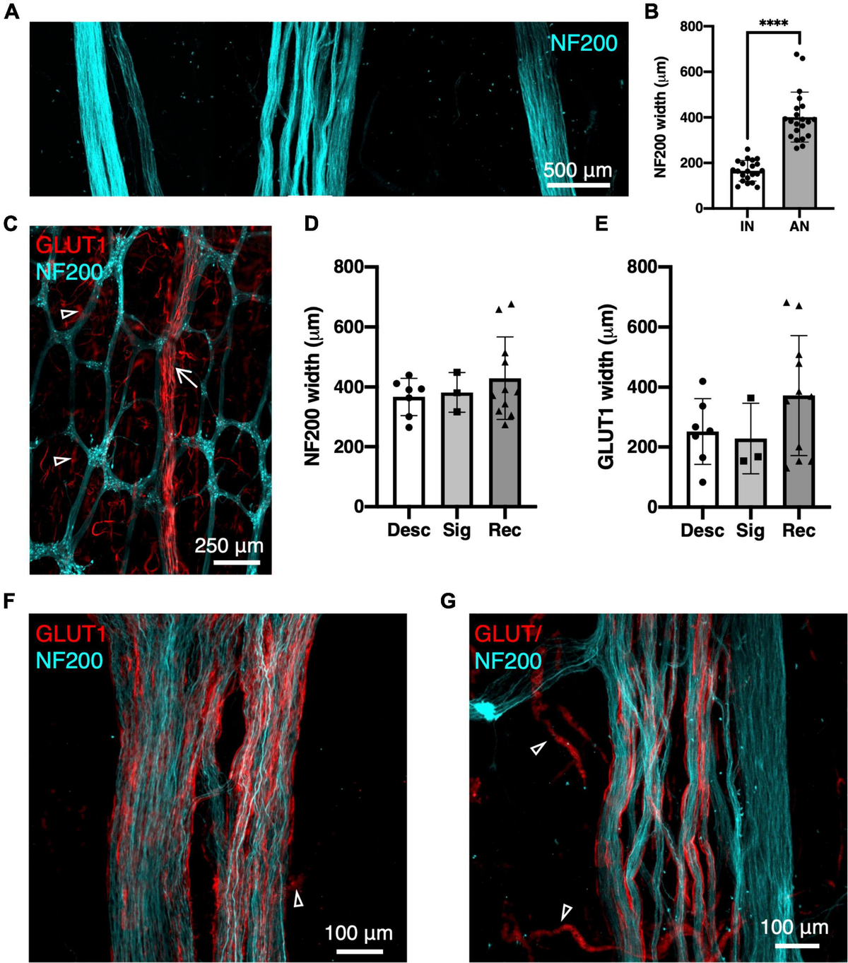 Frontiers | Characterisation of parasympathetic ascending nerves in ...