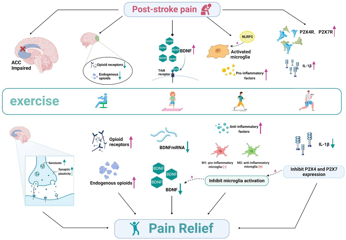 Frontiers | The effect and mechanism of exercise for post-stroke pain
