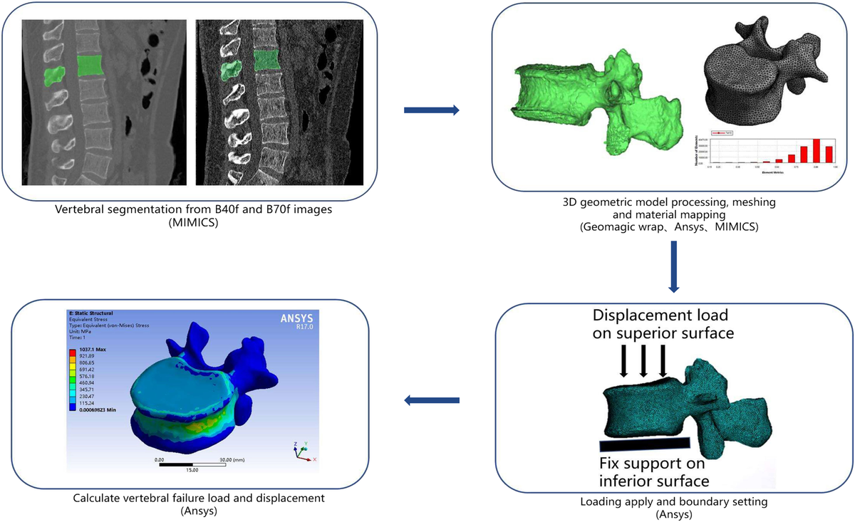 Frontiers | Influence of image reconstruction kernel on computed ...