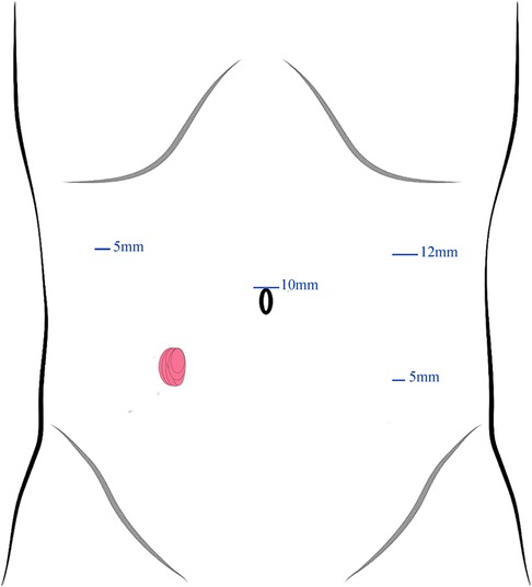 Frontiers | A multidimensional learning curve analysis of totally ...