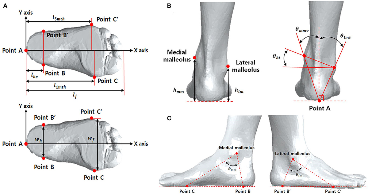 Frontiers | Bilateral ankle deformities affects gait kinematics in ...