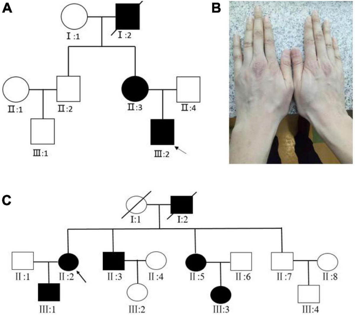 Frontiers | Novel and recurrent FBN1 mutations causing Marfan syndrome ...