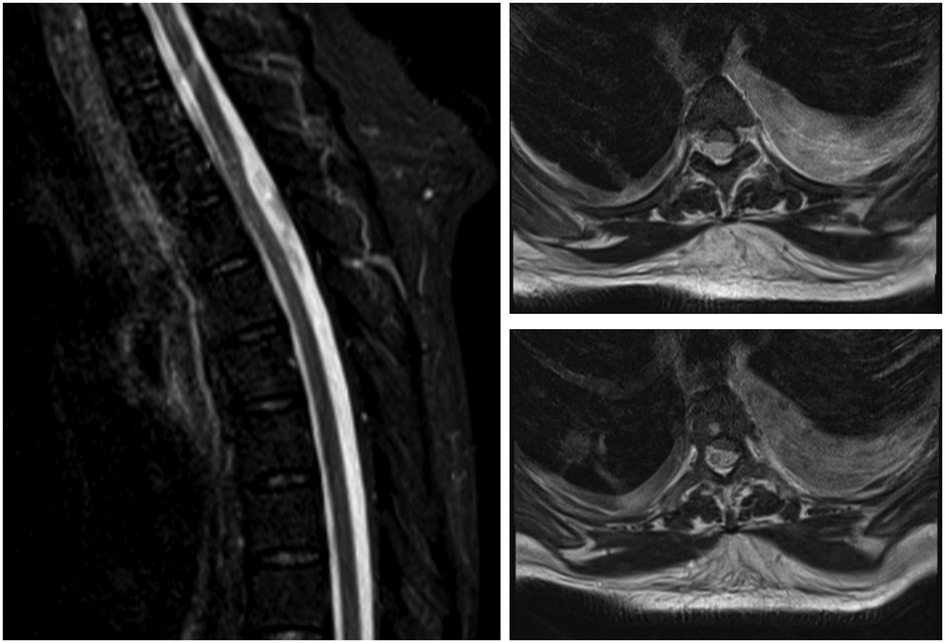 Frontiers | Diagnostic dilemma in acute neurological presentation of ...