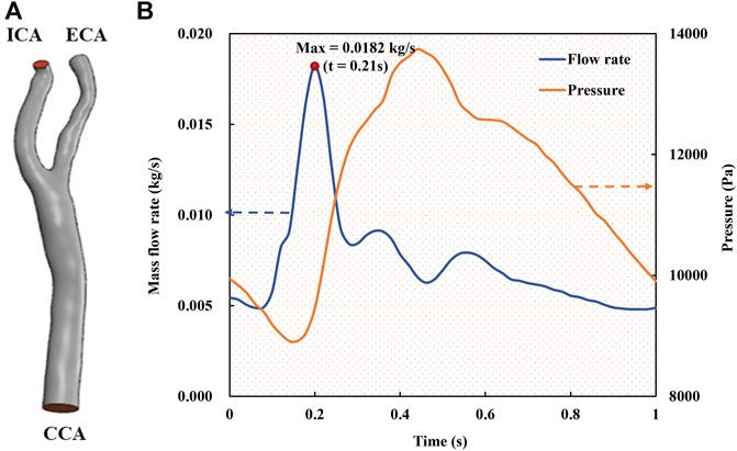 Frontiers | Deep learning-based hemodynamic prediction of carotid artery stenosis before and ...