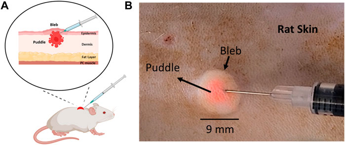 Frontiers | Molecular distribution in intradermal injection for ...