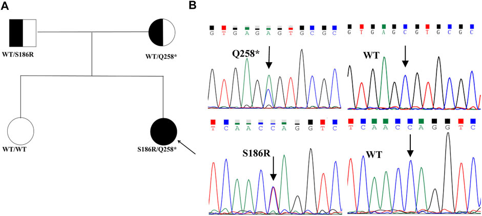Frontiers | Clinical and functional analyses of the novel STAR c.558C>A ...