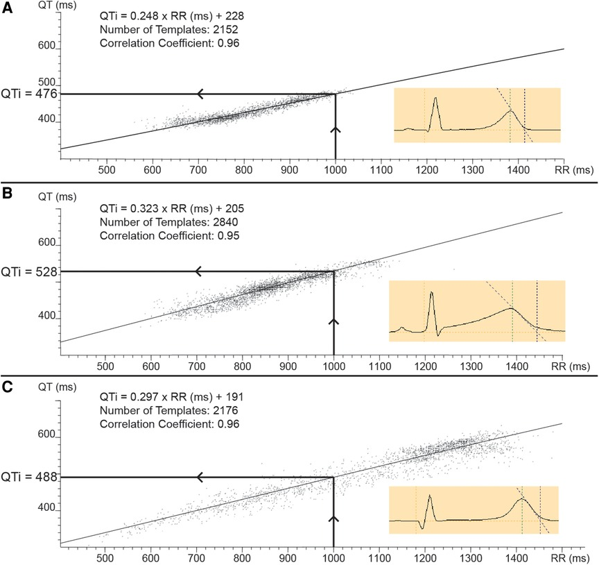 Frontiers | Individualized QT interval (QTi) is a powerful diagnostic ...