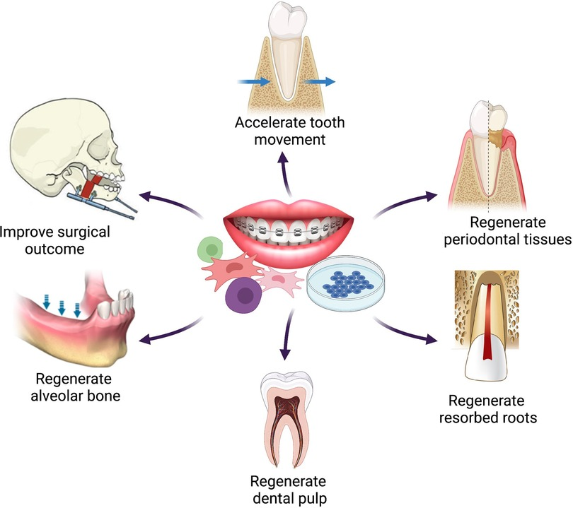 Frontiers | Applications of regenerative techniques in adult orthodontics