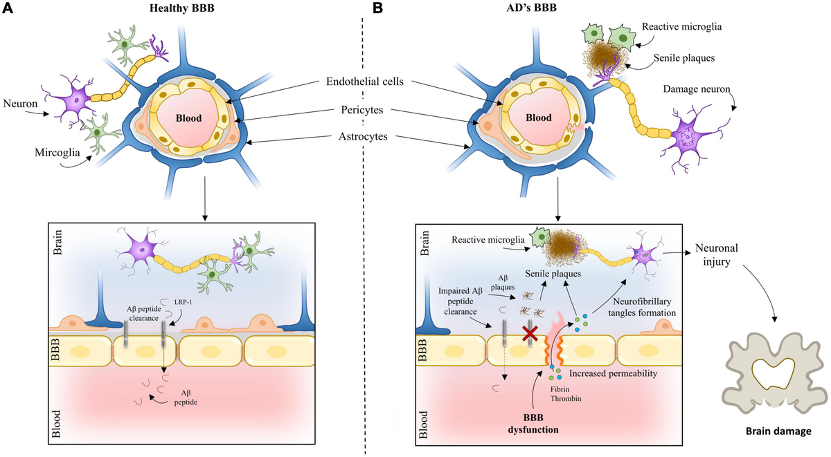 Frontiers | Reconsidering the role of blood-brain barrier in Alzheimer ...