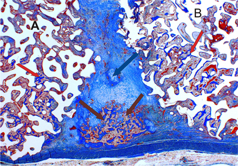 Frontiers | Bone Induction: Regeneration through Chaos