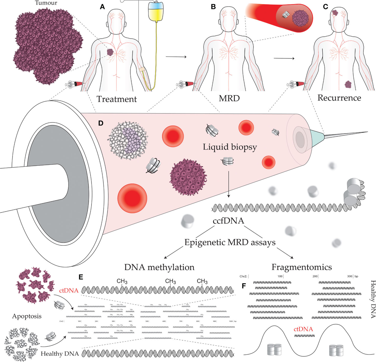 Frontiers | Epigenetic liquid biopsies for minimal residual disease ...