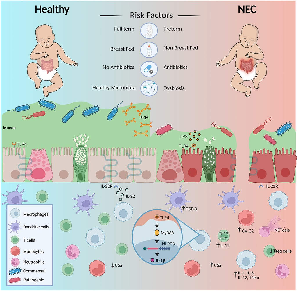 Frontiers | Necrotizing enterocolitis: Bench to bedside approaches and ...