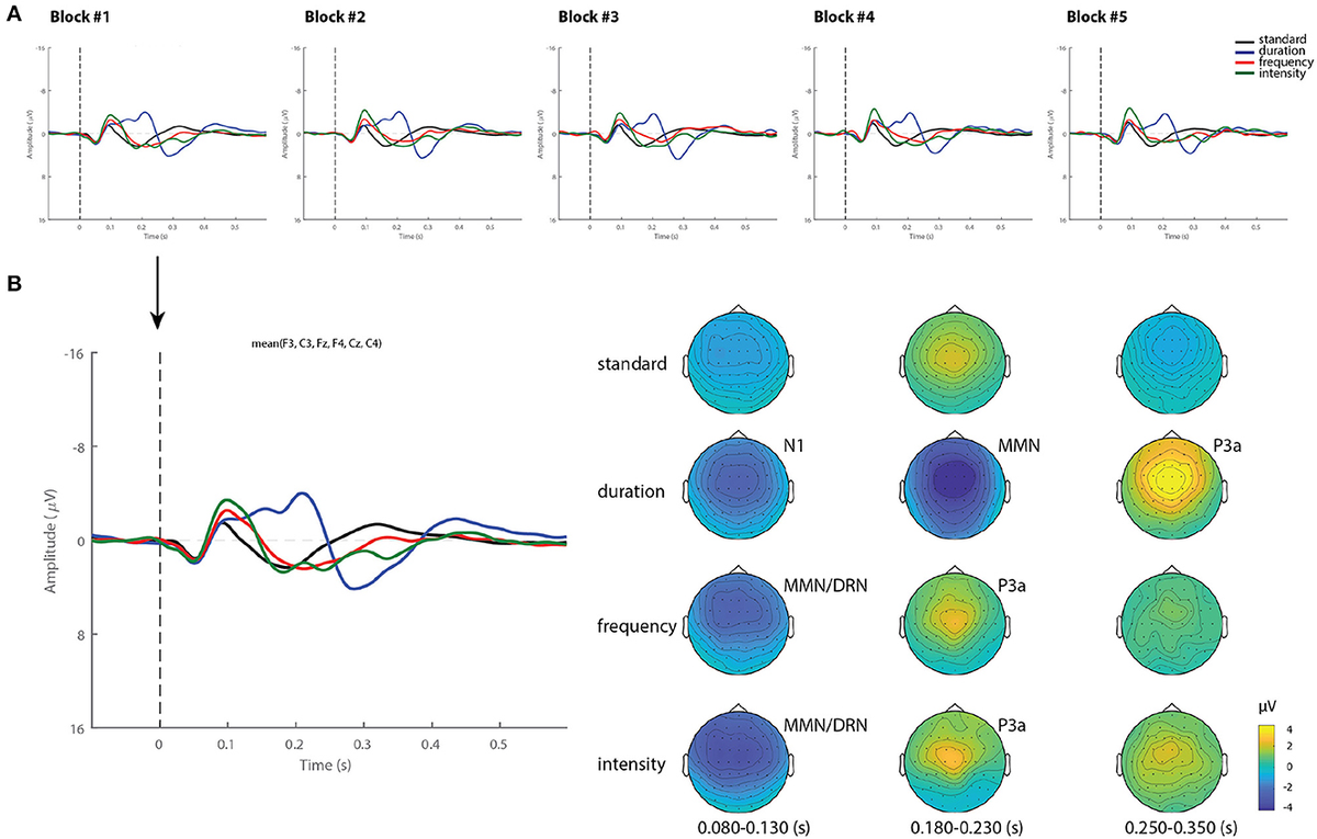 Frontiers | Tracking auditory mismatch negativity responses during full ...