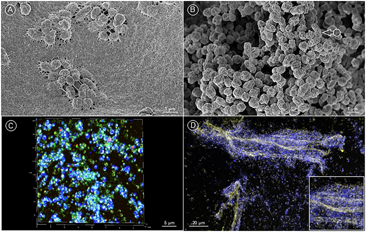Frontiers | Francisella tularensis subsp. holarctica wild-type is able ...