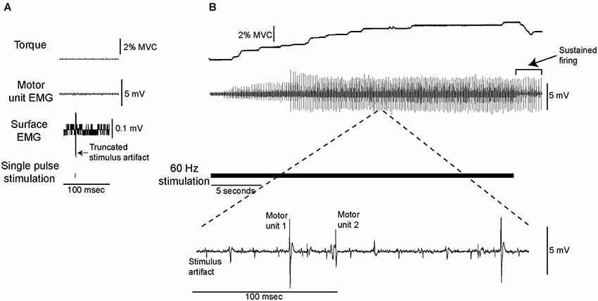 Frontiers | Asynchronous recruitment of low-threshold motor units ...