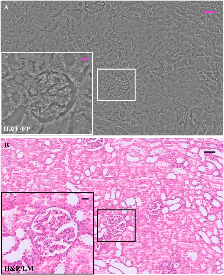Frontiers | Beyond conventional microscopy: Observing kidney tissues by ...
