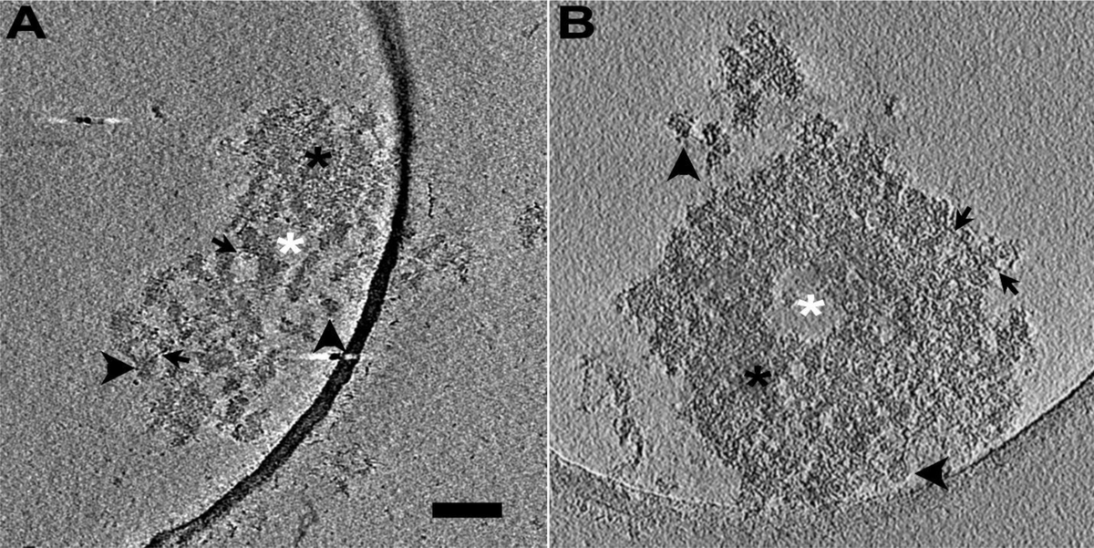 Frontiers | Cryo-EM tomography and automatic segmentation delineate modular structures in the ...