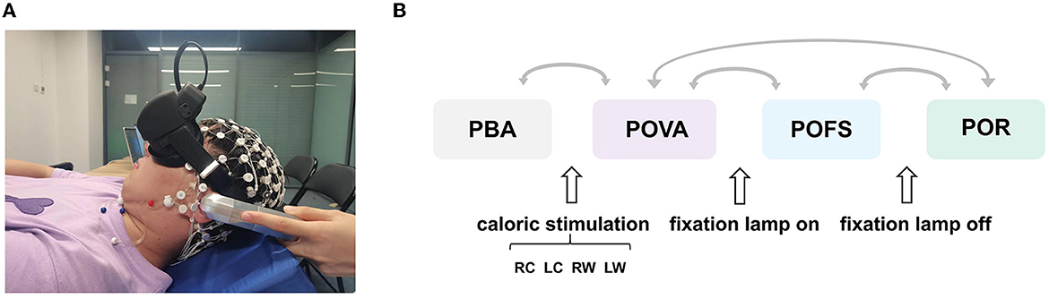 Frontiers | Assessing vestibular function using electroencephalogram ...
