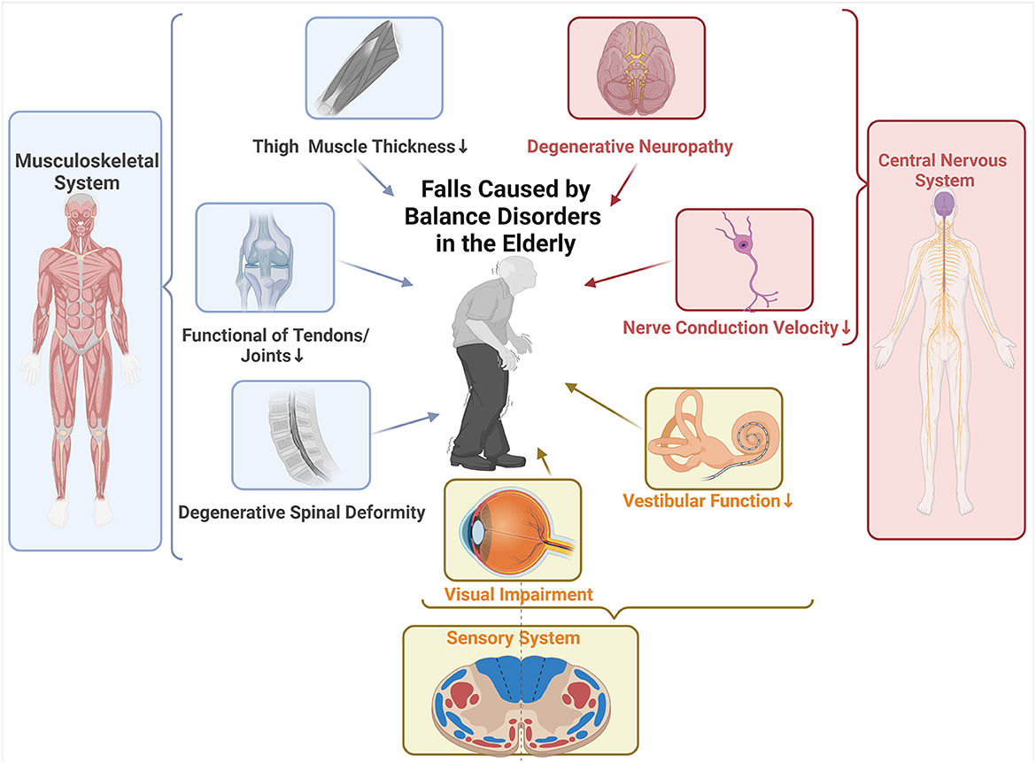 Frontiers | Falls caused by balance disorders in the elderly with ...