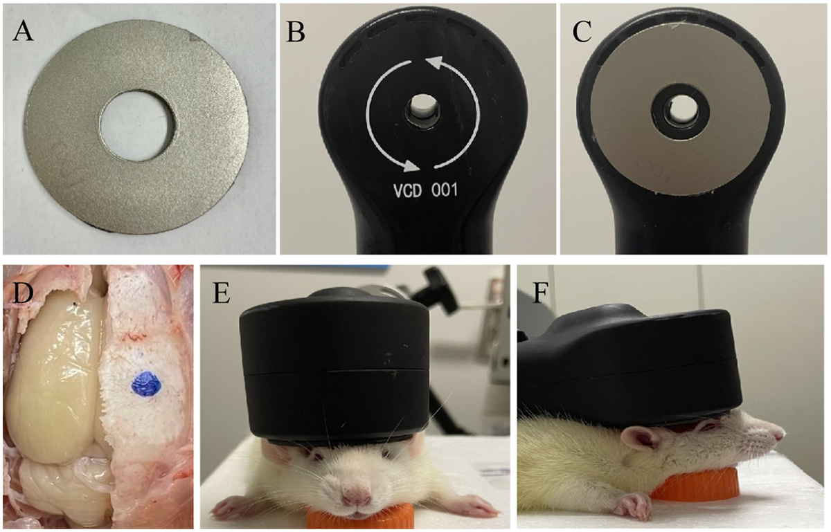 Frontiers | Design and evaluation of a rodent-specific focal transcranial magnetic stimulation ...
