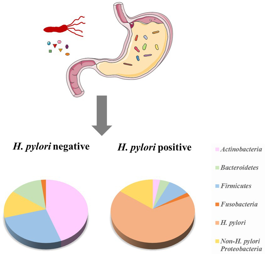 Frontiers | Gastric microbiota: an emerging player in gastric cancer