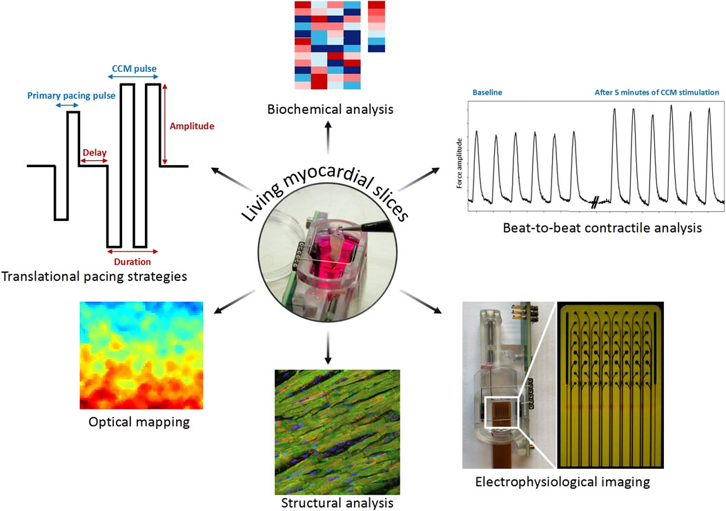 Frontiers | Commentary: Acute effects of cardiac contractility ...