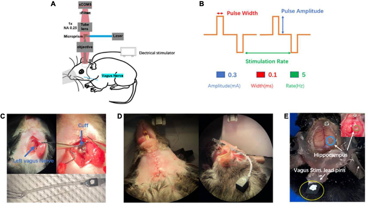 Frontiers | Cerebral cortex and hippocampus neural interaction during ...