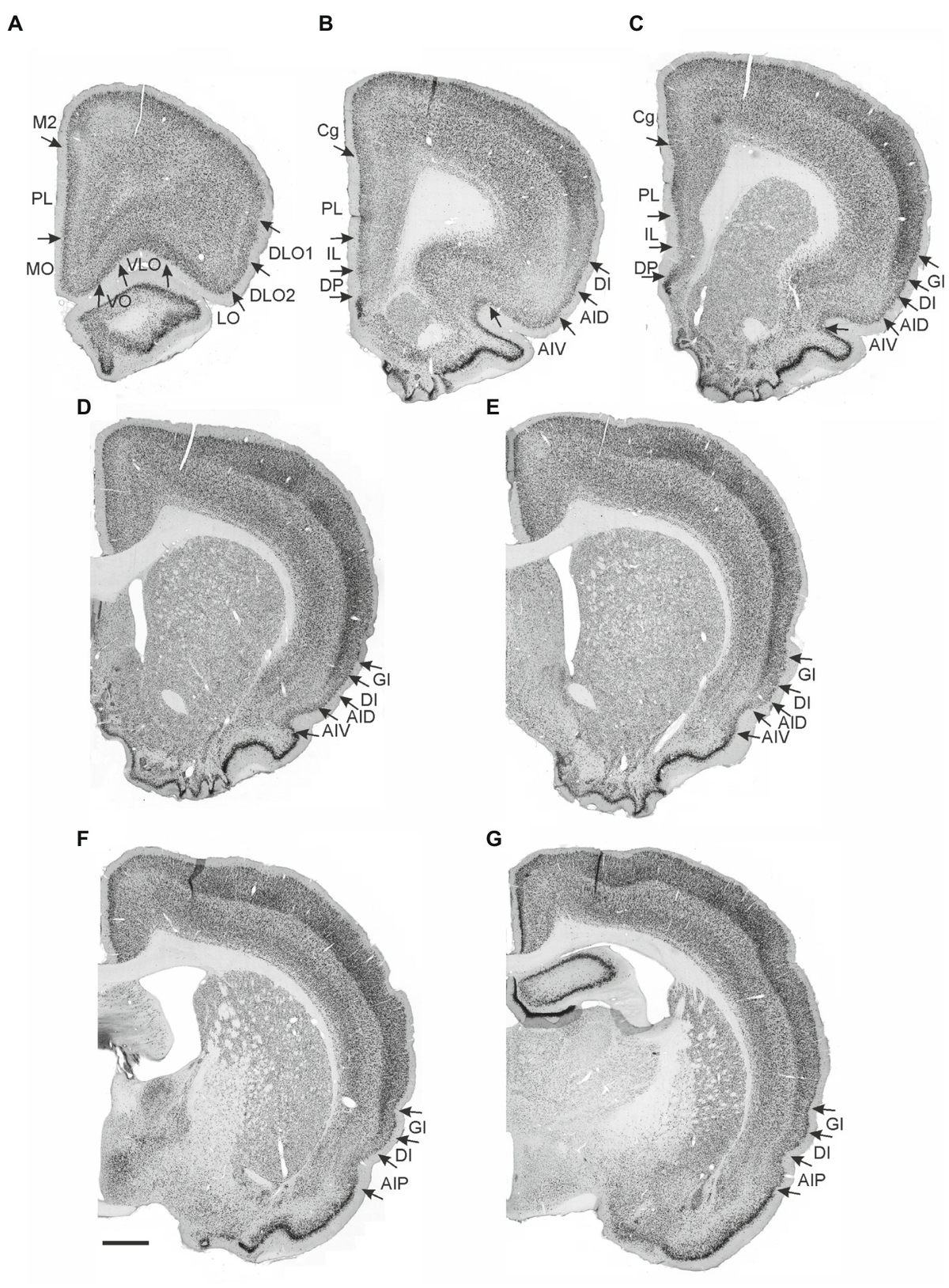 Frontiers | Projections of the insular cortex to orbitofrontal and ...
