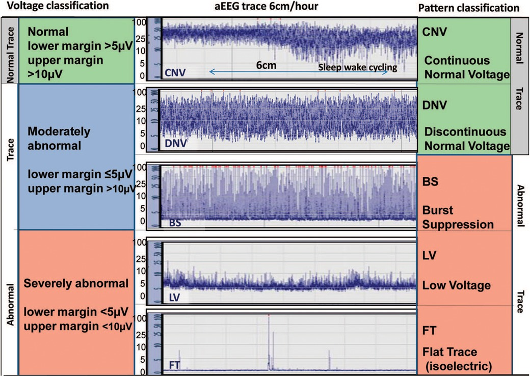 Frontiers | Optimal neuromonitoring techniques in neonates with hypoxic ...