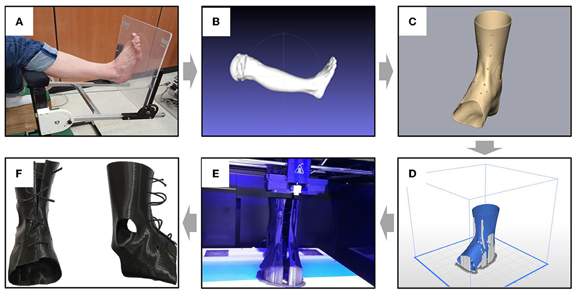 Frontiers | Effects of community ambulation training with 3D-printed ...