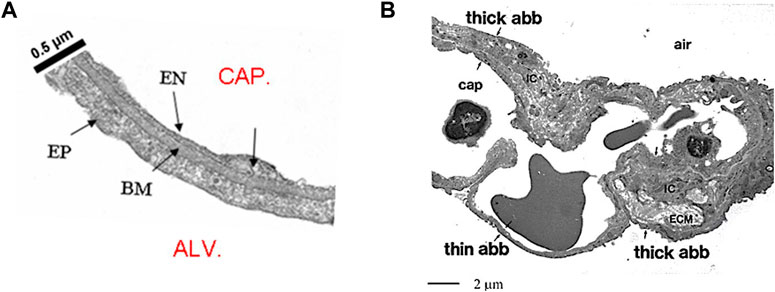 Frontiers | The impact of heterogeneity of the air-blood barrier on ...