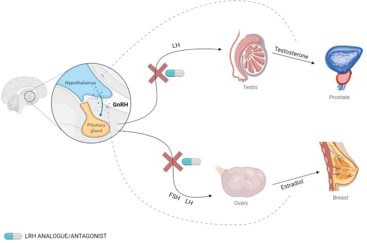 Frontiers | Conventional and new proposals of GnRH therapy for ovarian, breast, and prostatic ...