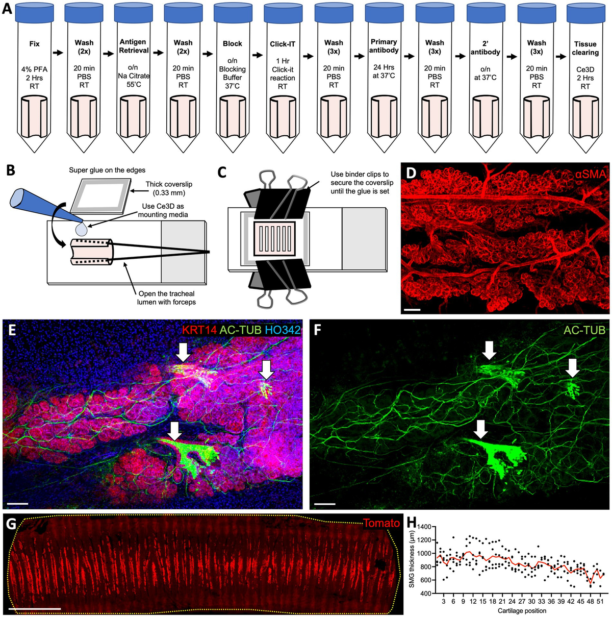 Frontiers | Development and characterization of ferret ex vivo tracheal ...