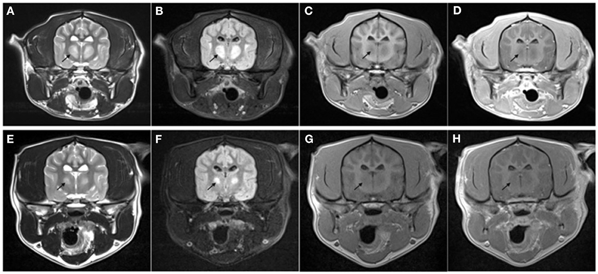 Frontiers | Case report: Recovery and sequential imaging of a patient ...