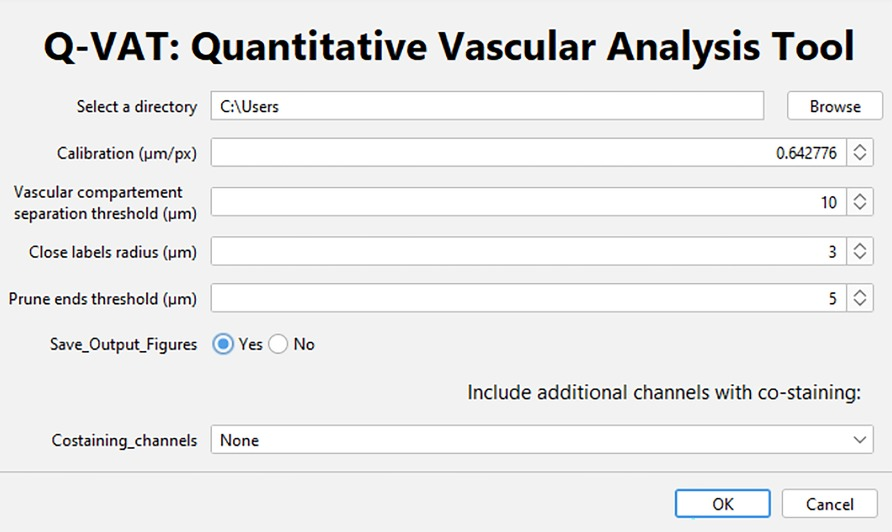 Frontiers | Q-VAT: Quantitative Vascular Analysis Tool