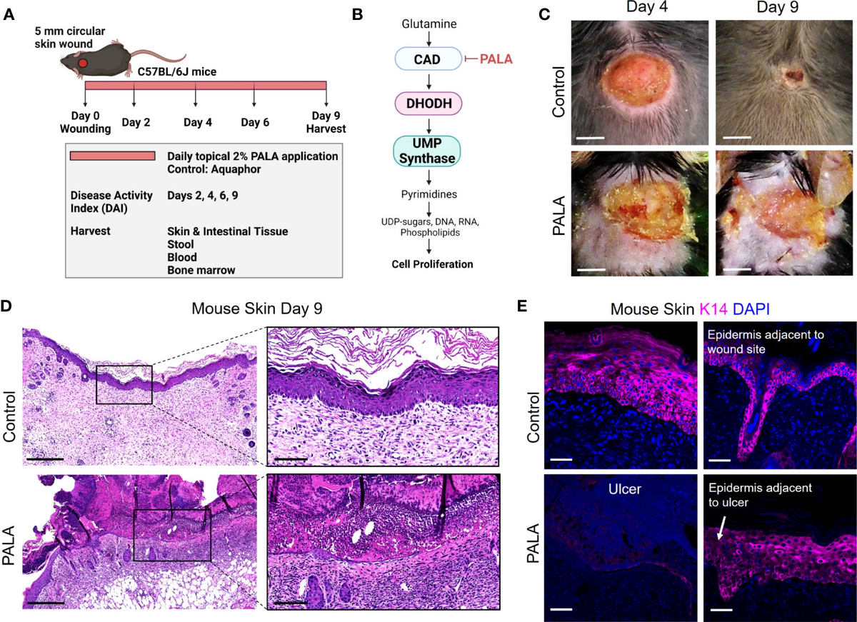 Frontiers | A novel murine model of pyoderma gangrenosum reveals that ...