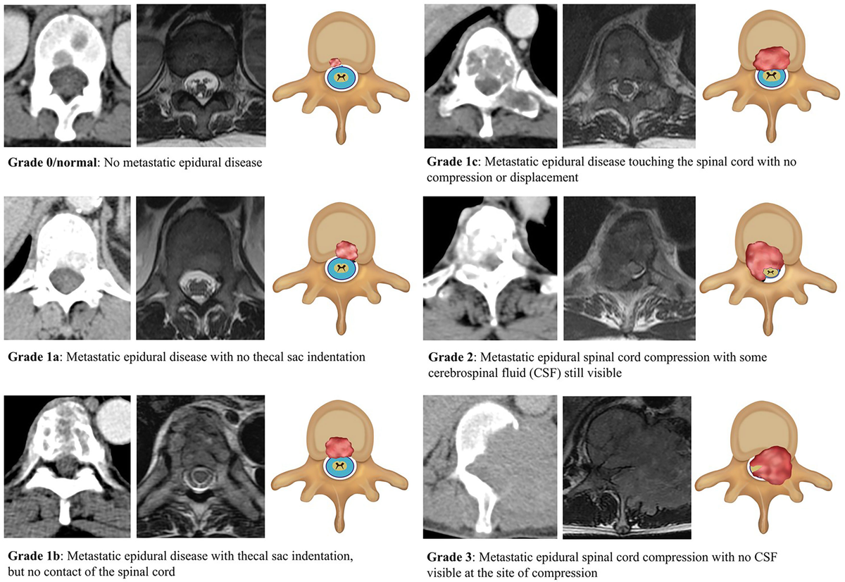 Frontiers | Deep learning assessment compared to radiologist reporting ... Frontiers | Deep learning assessment compared to radiologist reporting ...