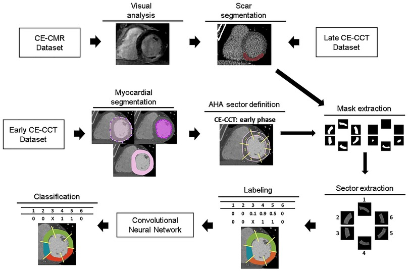 Frontiers | A deep-learning approach for myocardial fibrosis detection ...