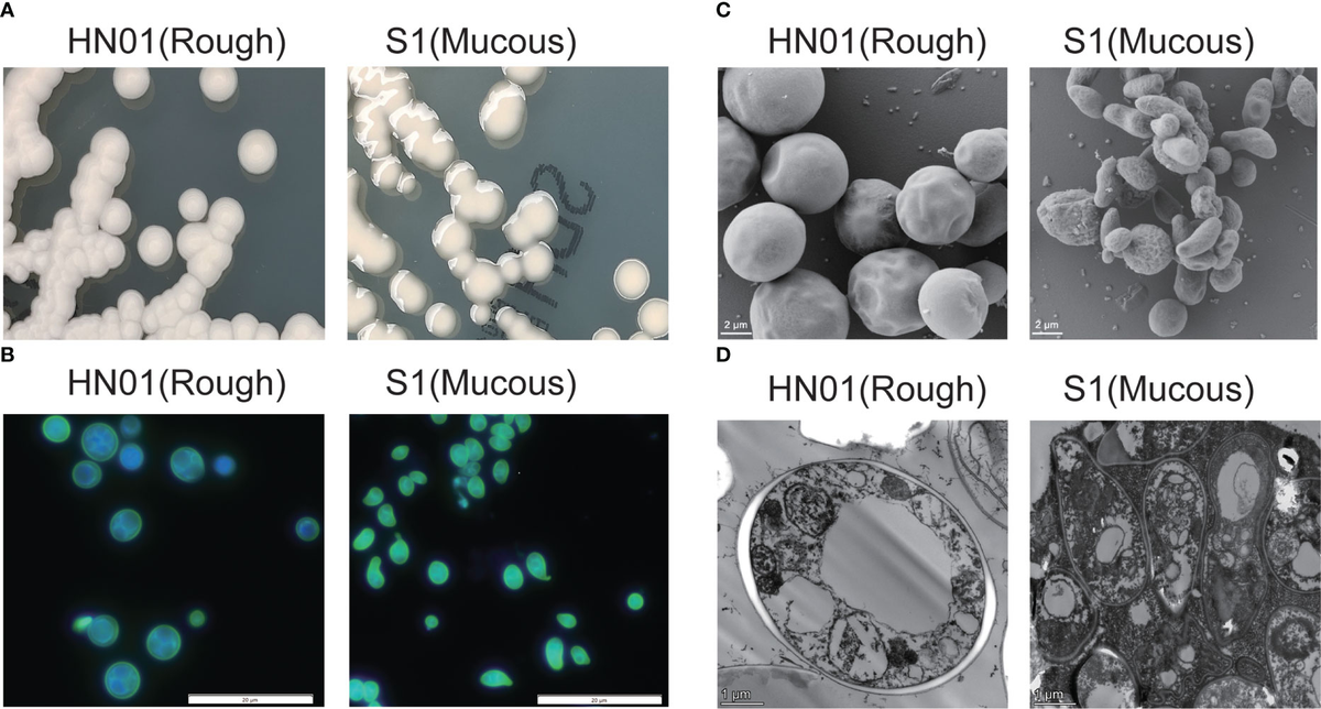 Frontiers | Integration of transcriptomics, proteomics, and ...