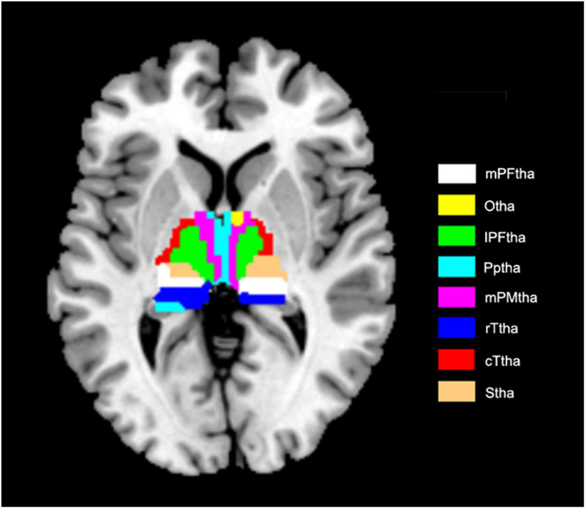 Frontiers Abnormal Dynamic Functional Connectivity Of Thalamic