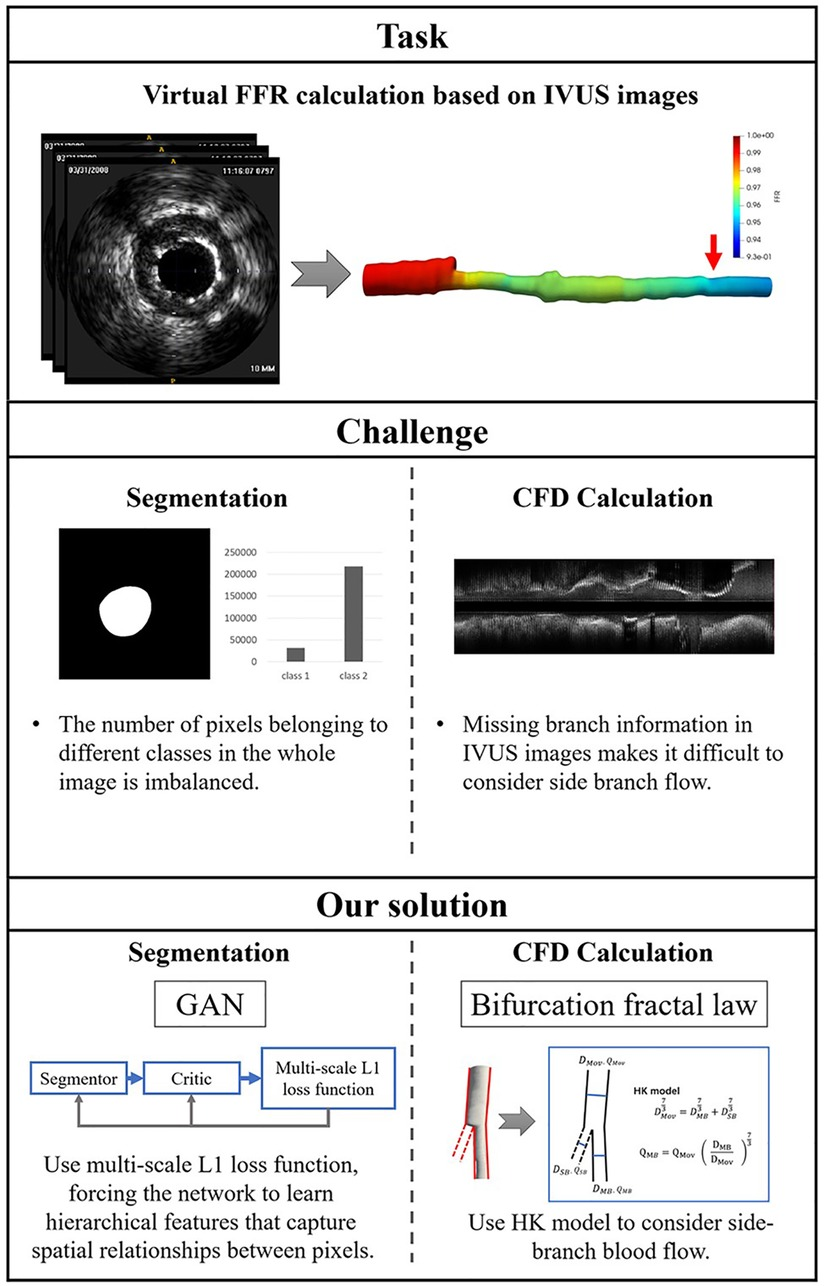 Frontiers | Diagnostic performance of IVUS-FFR analysis based on generative adversarial network ...