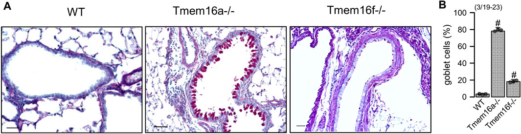 Frontiers | TMEM16A/F support exocytosis but do not inhibit Notch ...