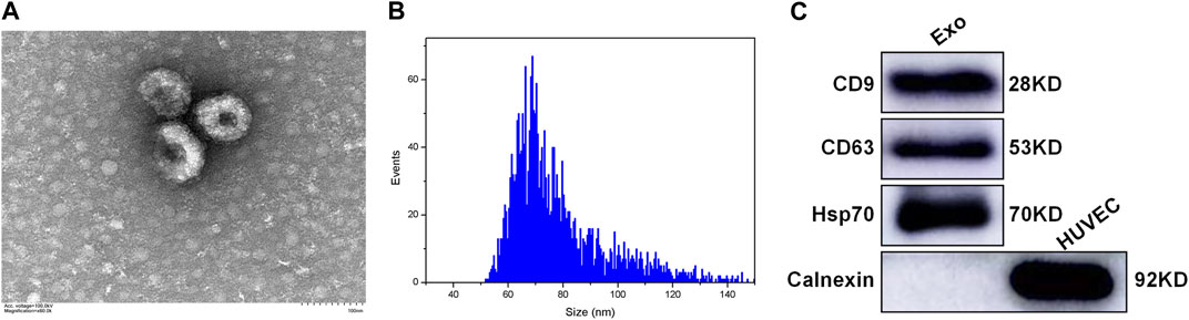Frontiers | Plasma-derived exosomal let-7c-5p, miR-335–3p, and miR-652 ...