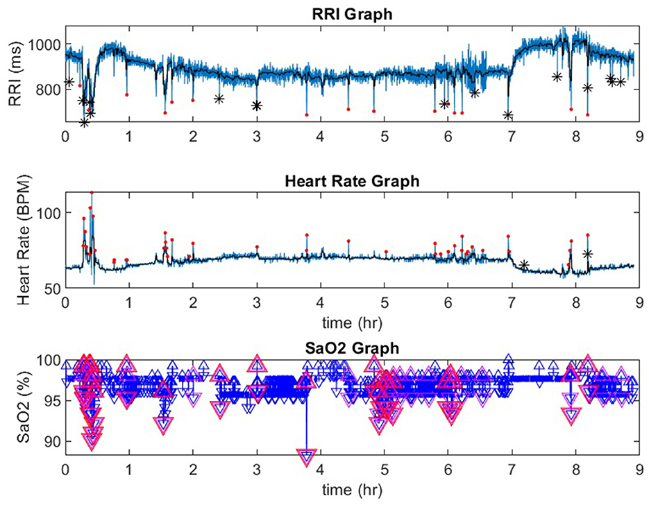Frontiers | Role of automated detection of respiratory related heart ...