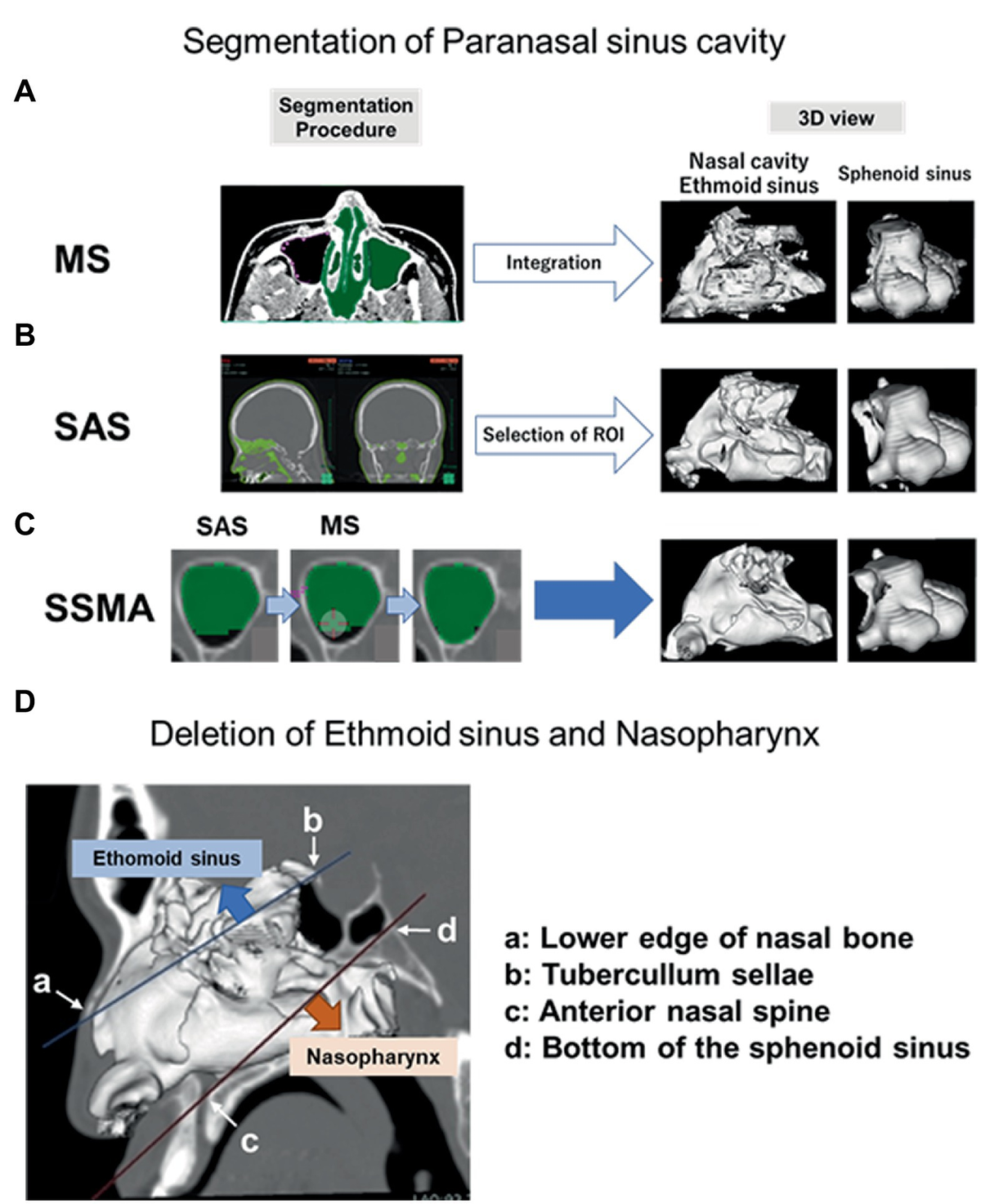 Frontiers | Volumetric measurement of paranasal sinuses and its ...